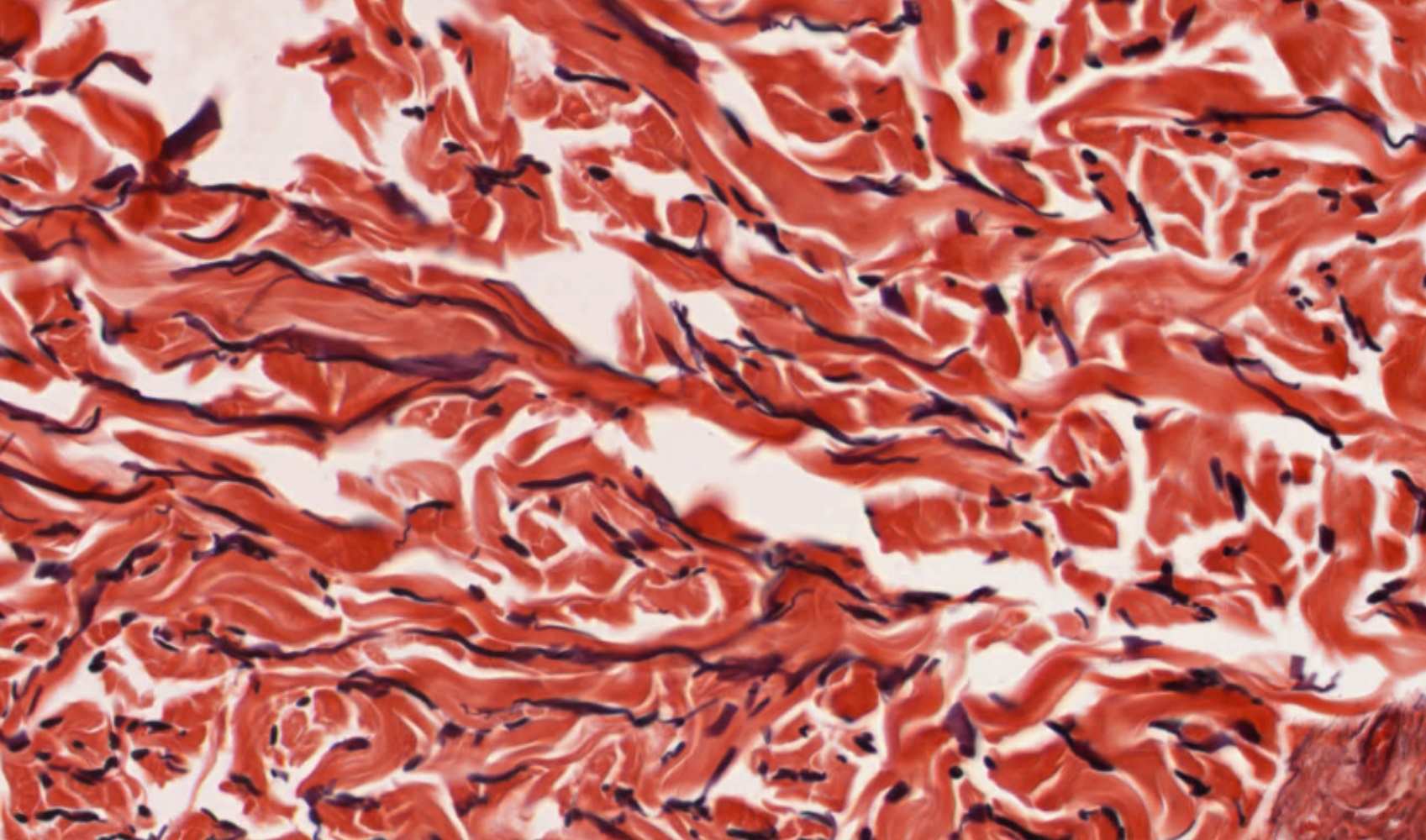 Dense Connective Tissues: Dense Irregular – Most Things Biology