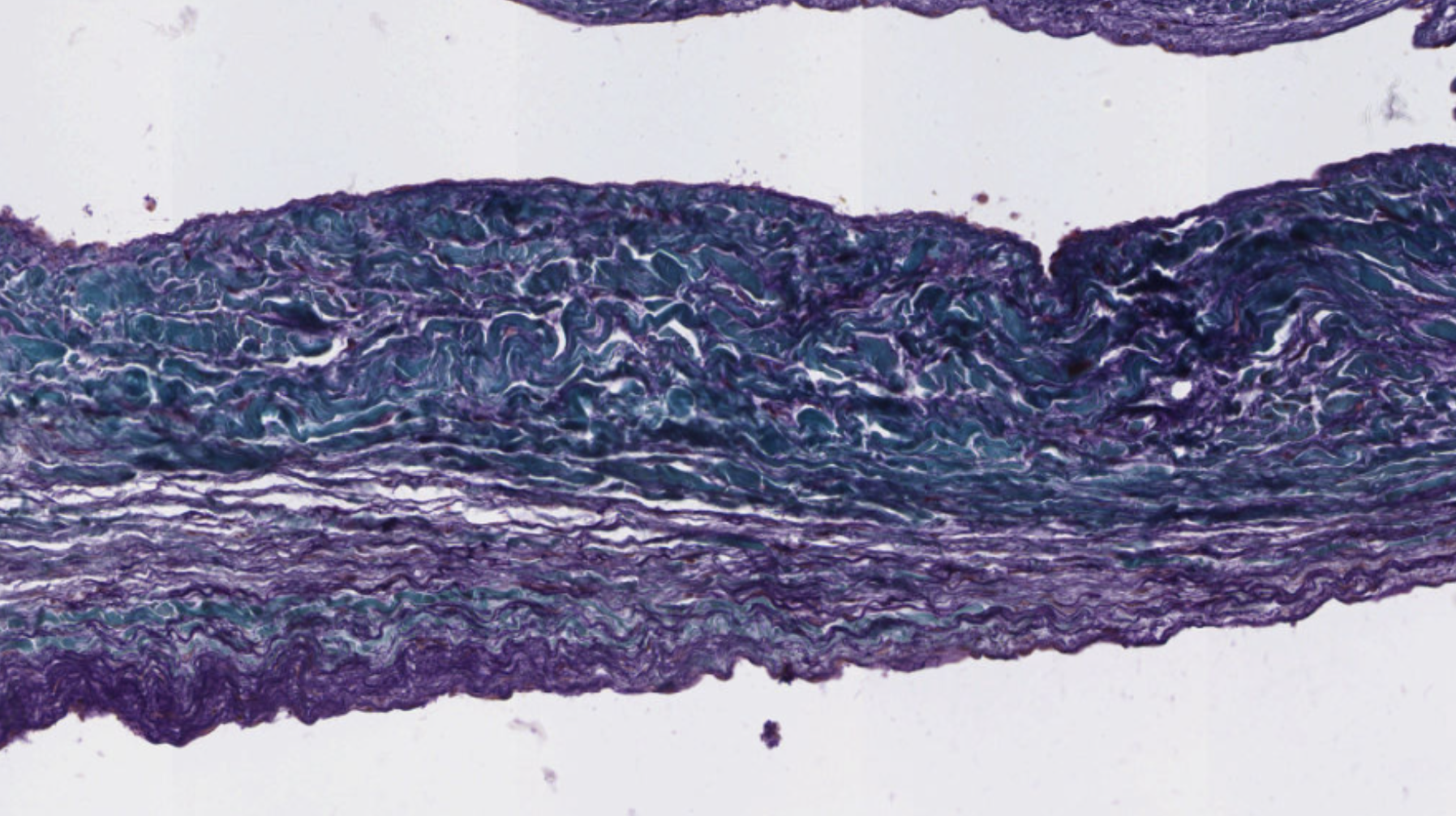 Understanding the Endocardium: Structure & Function